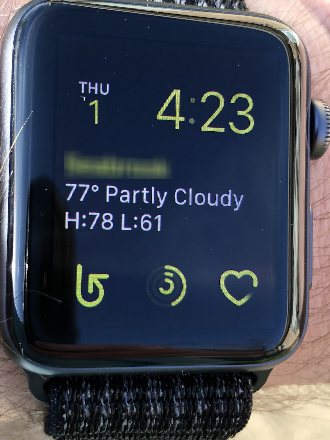 Apple Watch Screen Issue | MacRumors Forums Apple Watch Screen Issue | MacRumors Forums